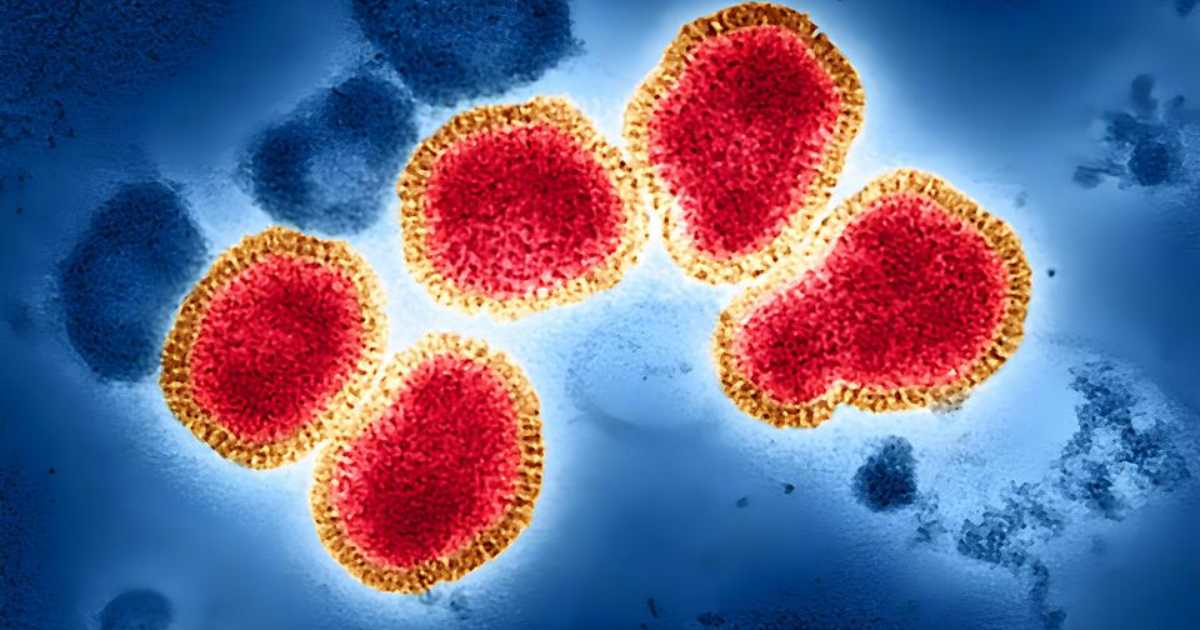 The New H3N2 Virus: Here Are The Symptoms To Look For